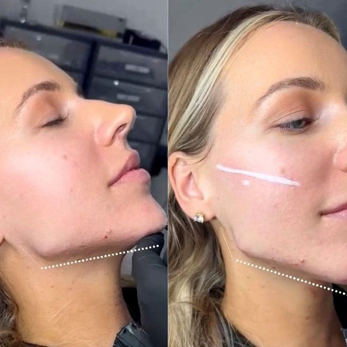 Online Courses – FACES Aesthetics and Training